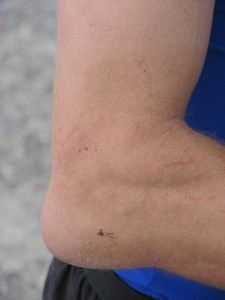 My swollen elbow - Veterinary Secrets with Dr. Andrew Jones, DVM