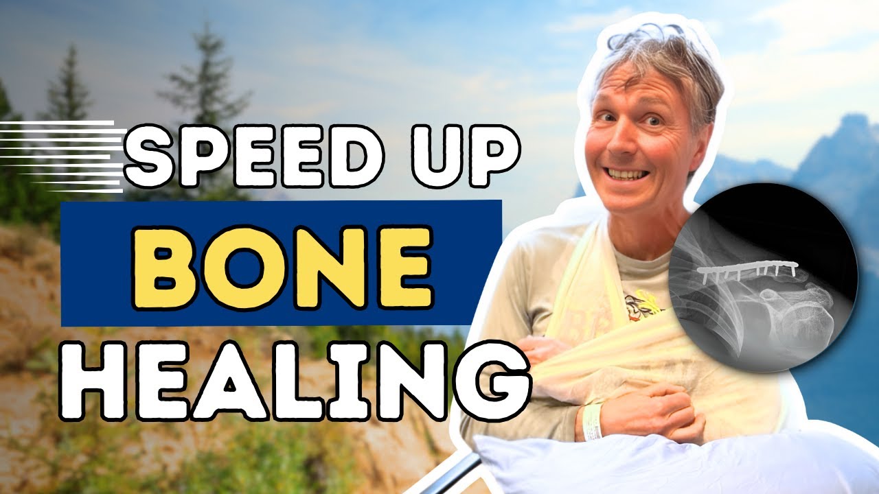 Recovering from a Broken Collarbone: Top 5 Remedies for Rapid Bone ...
